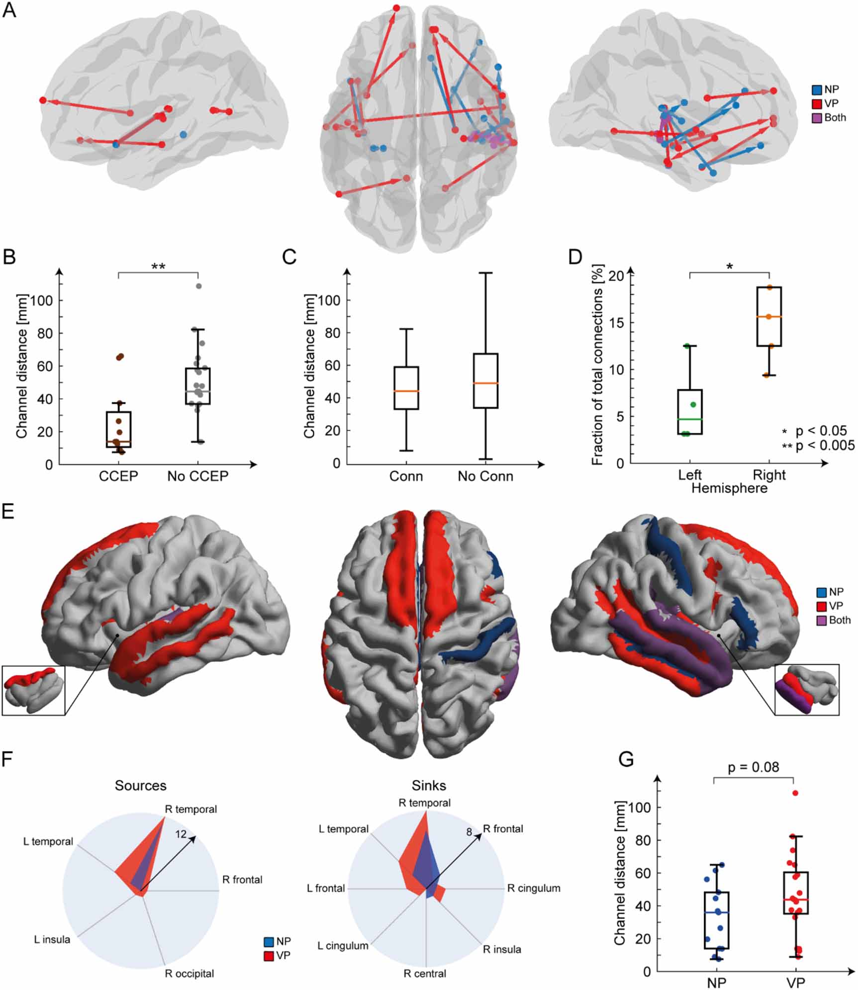 Event-related causality in stereo-EEG discriminates syntactic ...