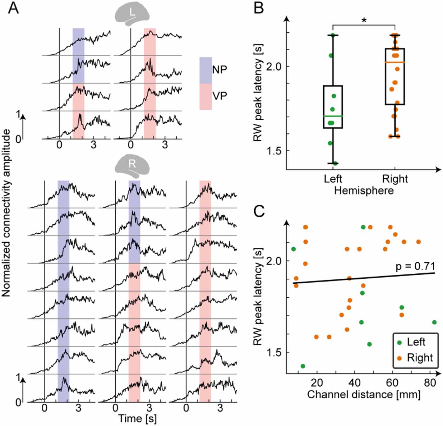 Event-related causality in stereo-EEG discriminates syntactic ...