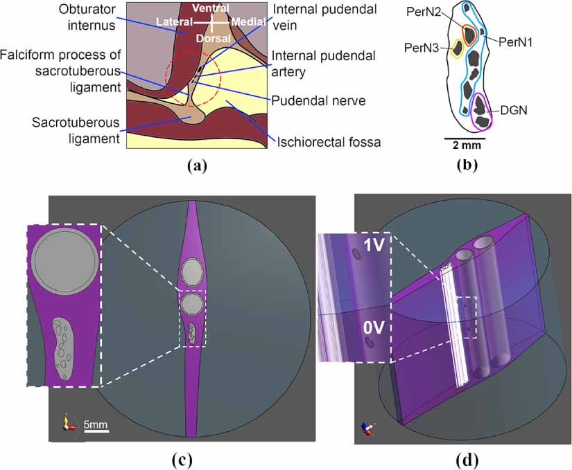 Computational modeling of endovascular peripheral nerve stimulation ...