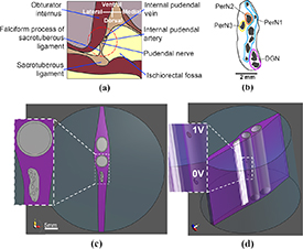Computational modeling of endovascular peripheral nerve stimulation ...