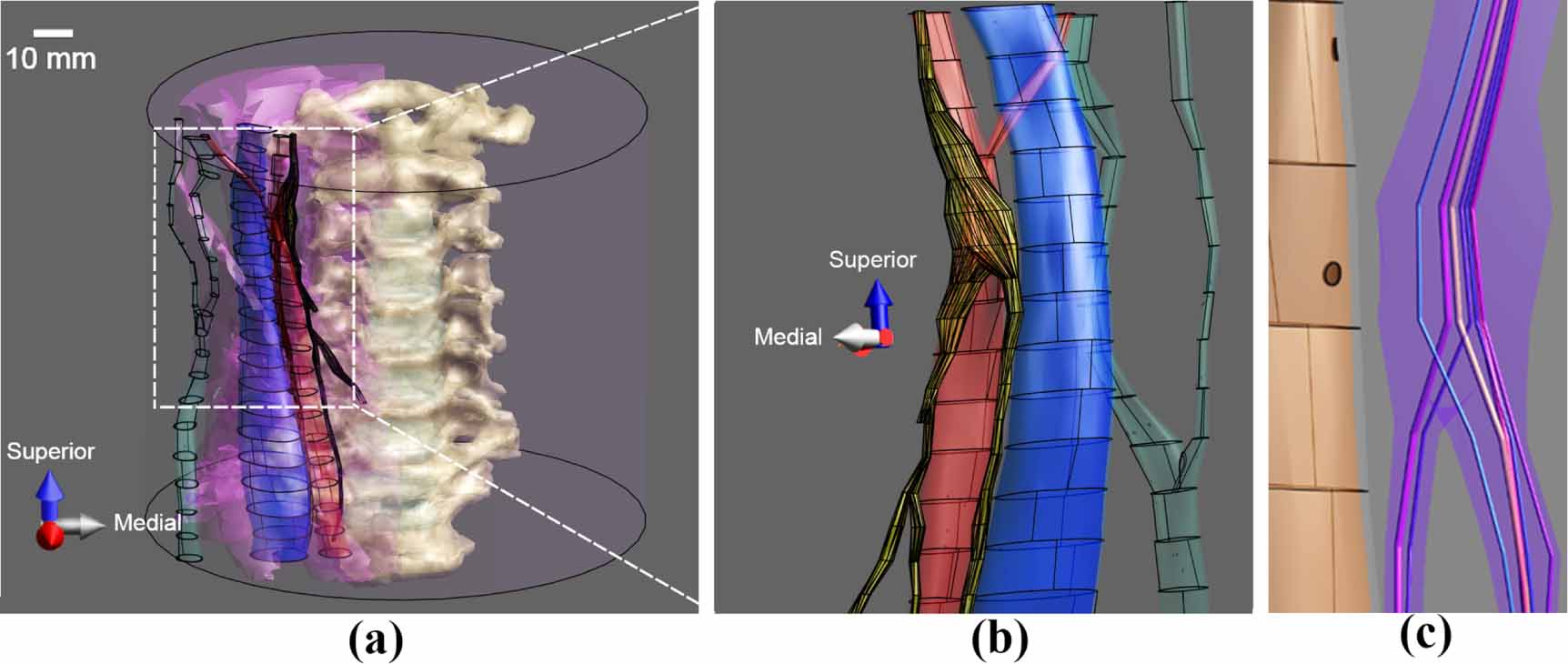 Computational modeling of endovascular peripheral nerve stimulation ...