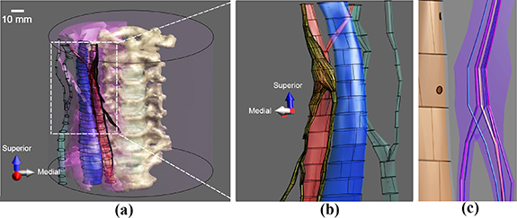 Computational modeling of endovascular peripheral nerve stimulation ...