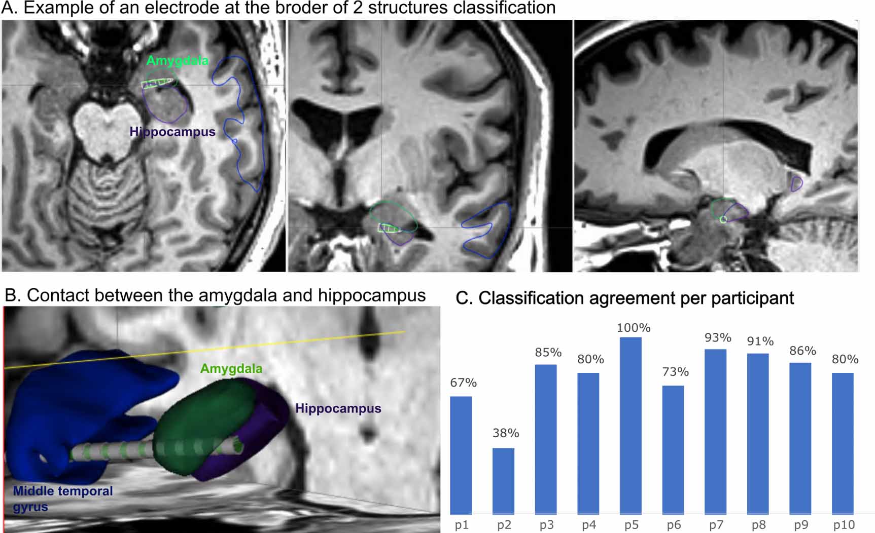 SEEGAtlas: A framework for the identification and classification of ...