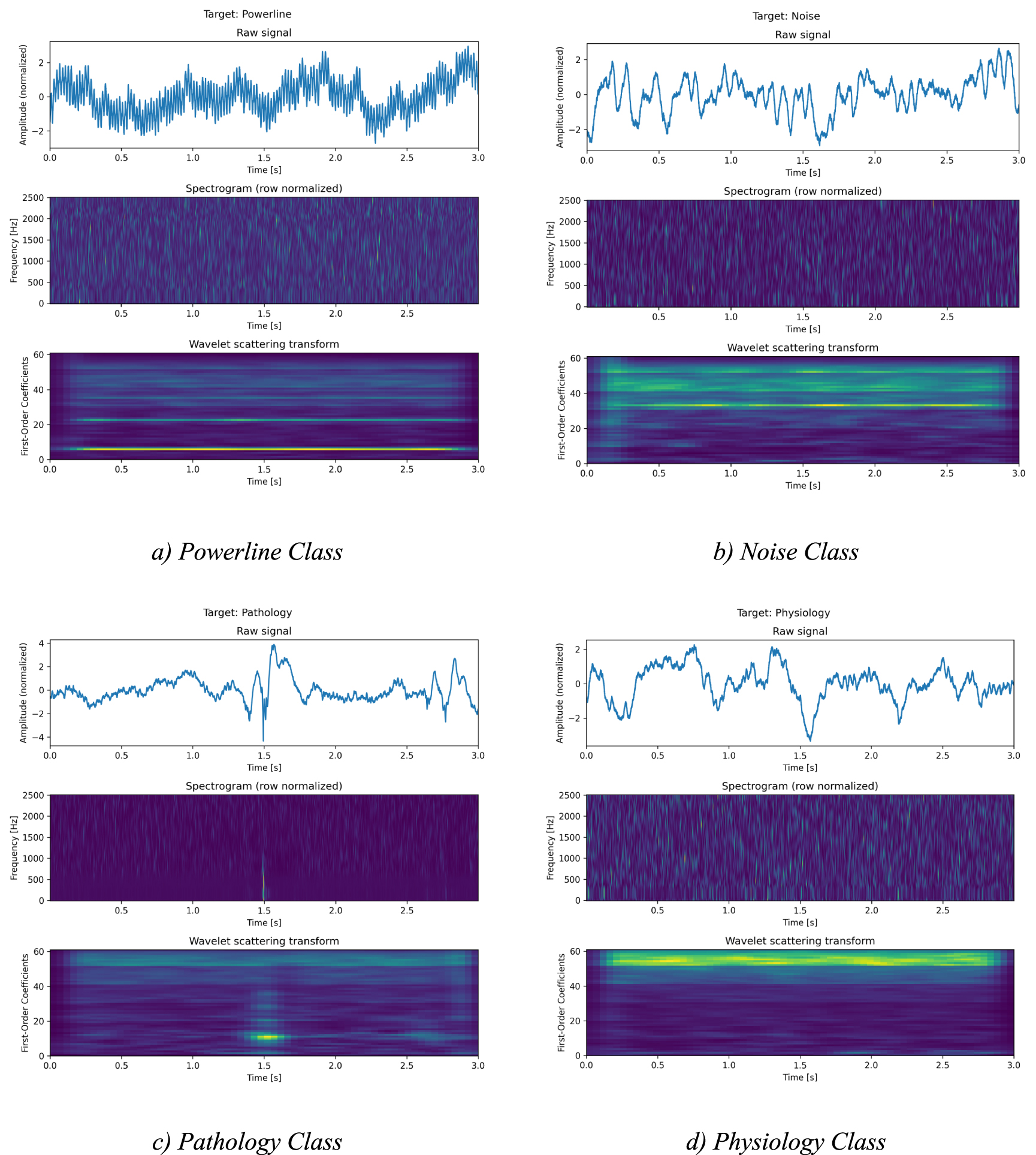 Genetic algorithm designed for optimization of neural network architectures for intracranial EEG ...