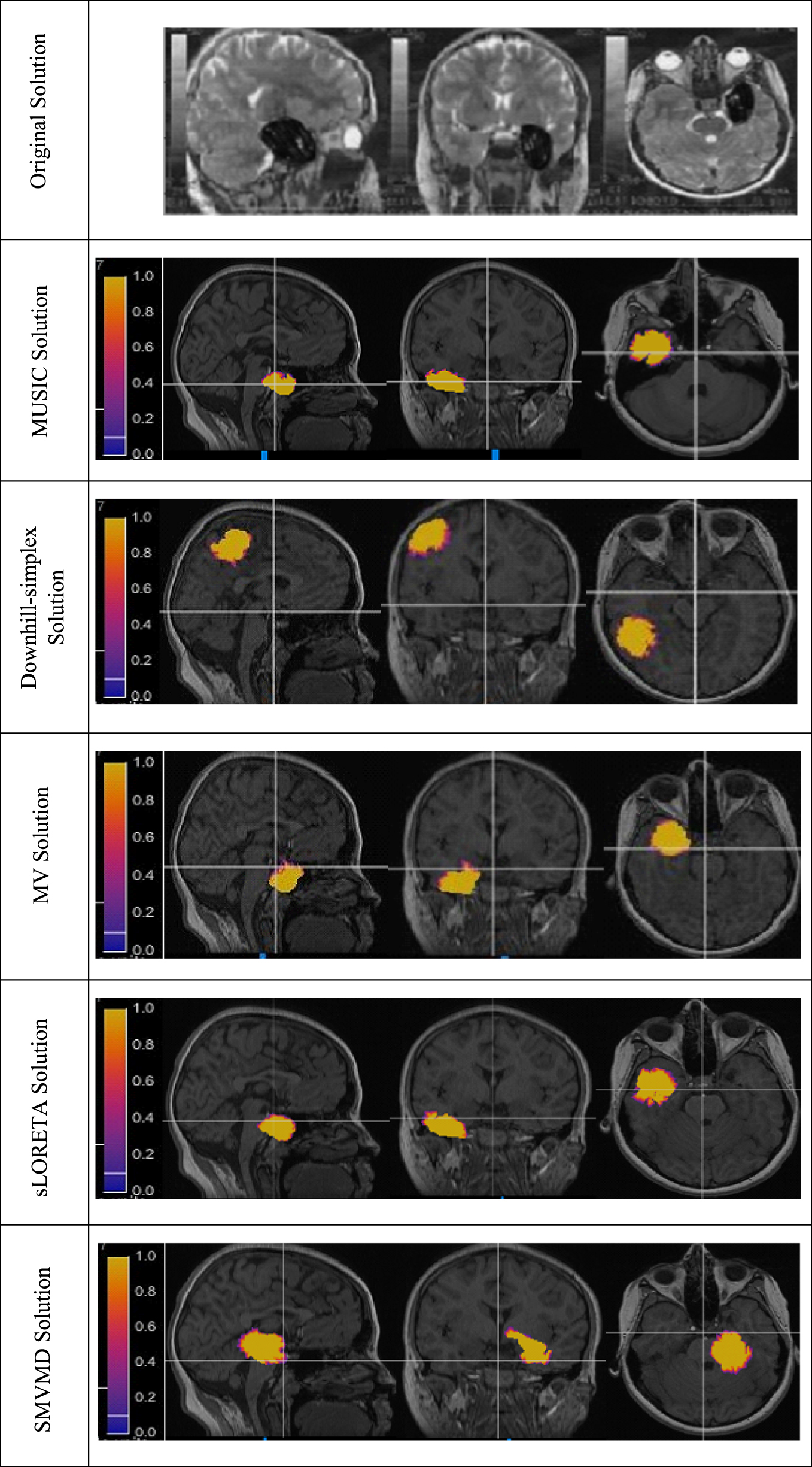A novel brain source reconstruction using a multivariate mode ...