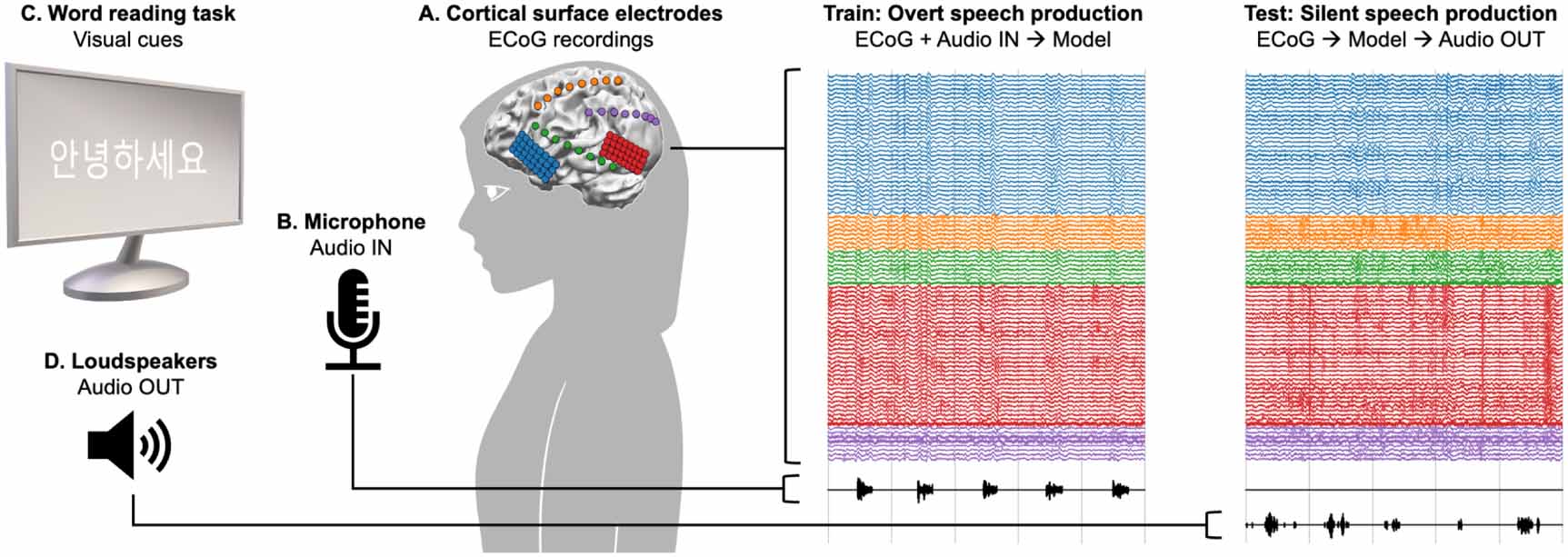 Continuous synthesis of artificial speech sounds from human cortical ...