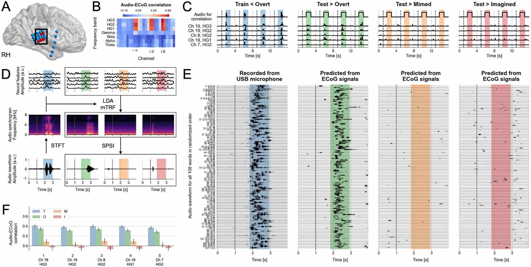 Continuous synthesis of artificial speech sounds from human cortical ...