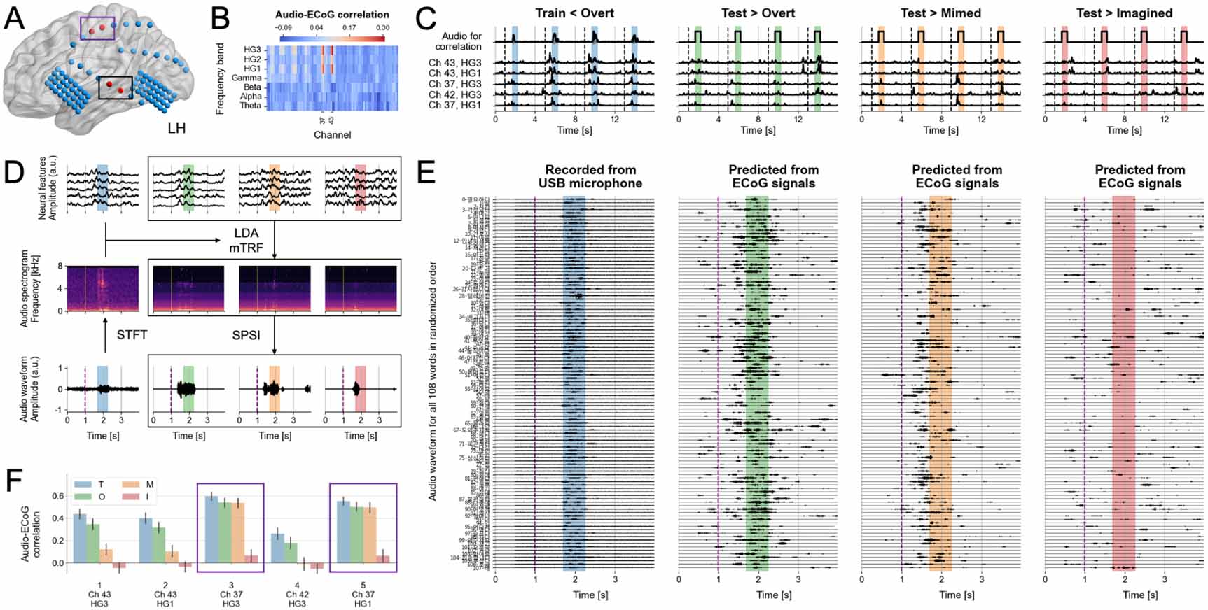 Continuous synthesis of artificial speech sounds from human cortical ...
