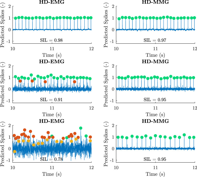 High-density magnetomyography is superior to high-density surface ...