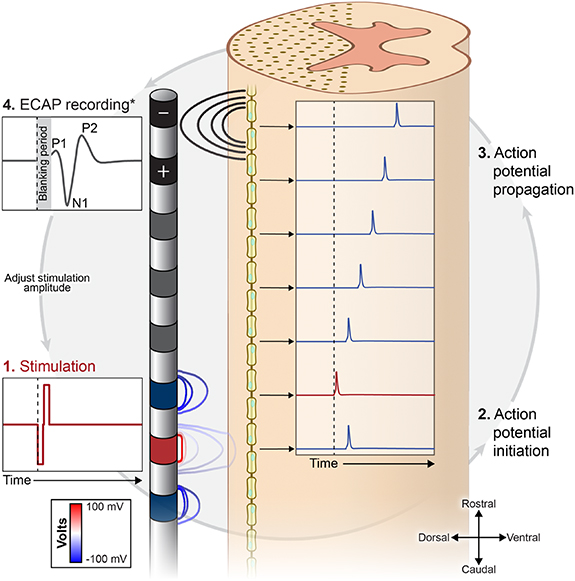 Evoked compound action potentials during spinal cord stimulation: effects of posture and pulse ...
