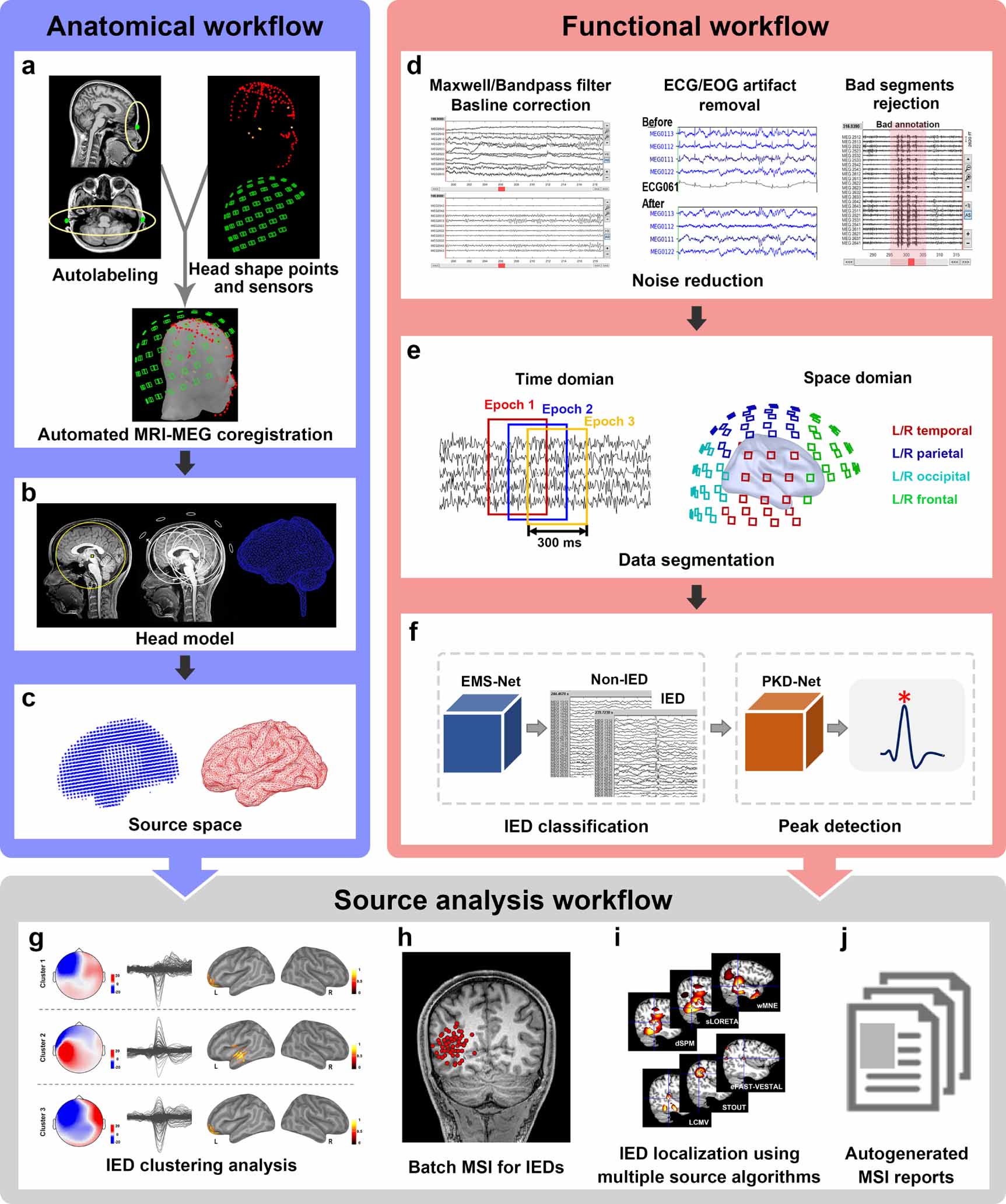 An artificial intelligence–based pipeline for automated detection and localisation of epileptic ...