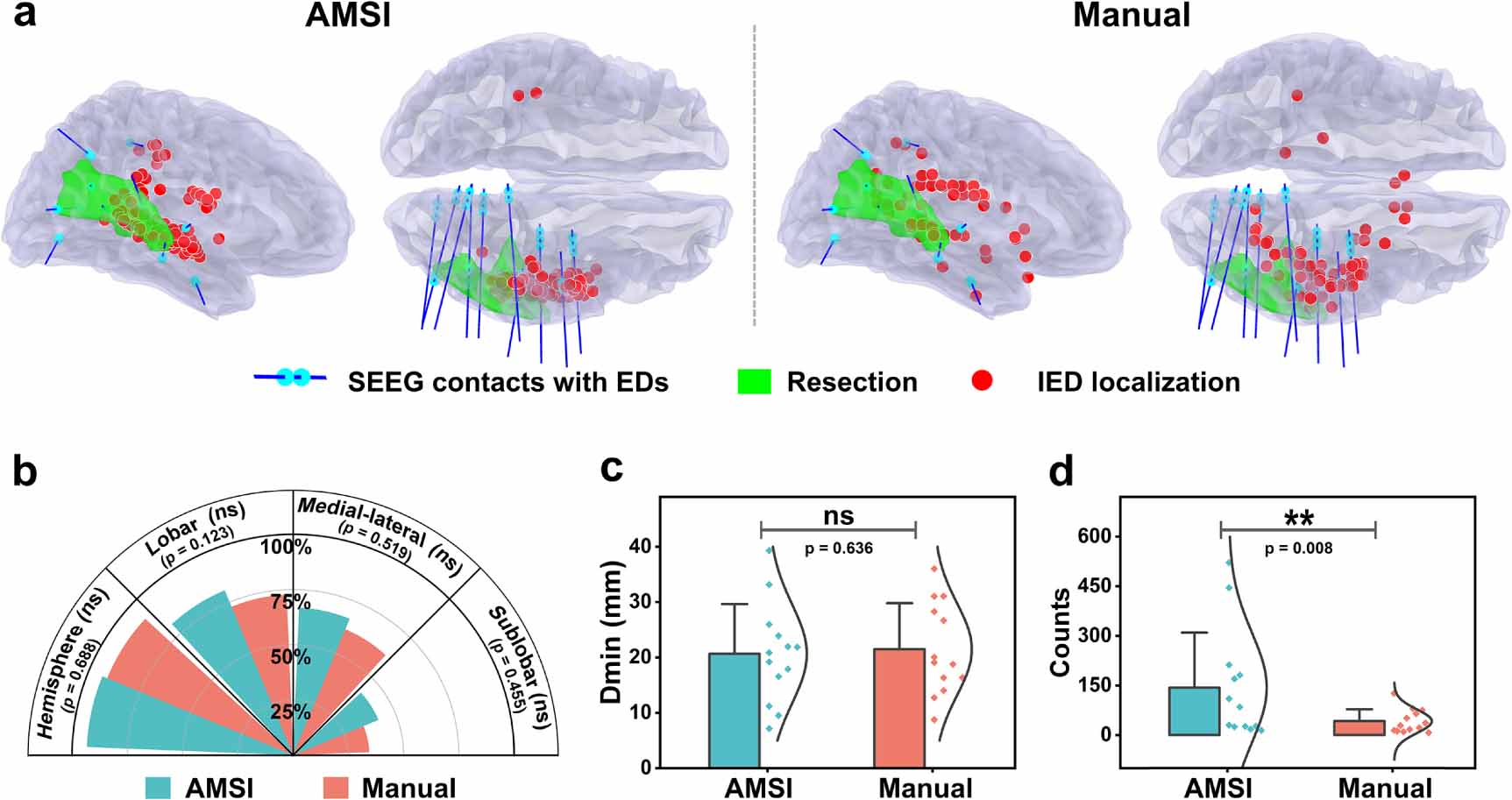 An artificial intelligence–based pipeline for automated detection and localisation of epileptic ...