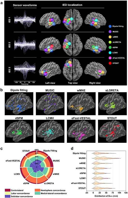 An artificial intelligence–based pipeline for automated detection and localisation of epileptic ...