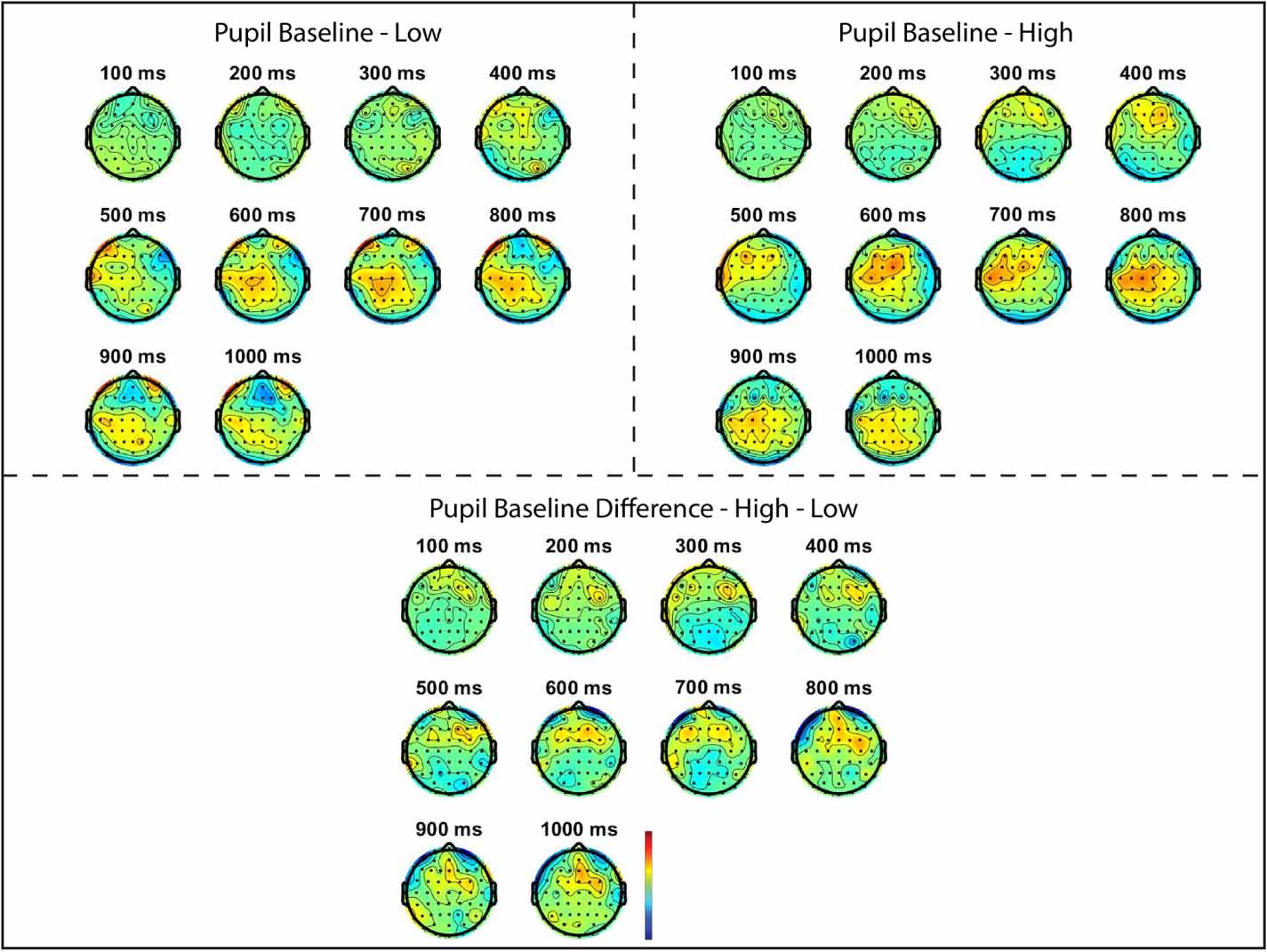 Pupil-linked arousal modulates network-level EEG signatures of ...