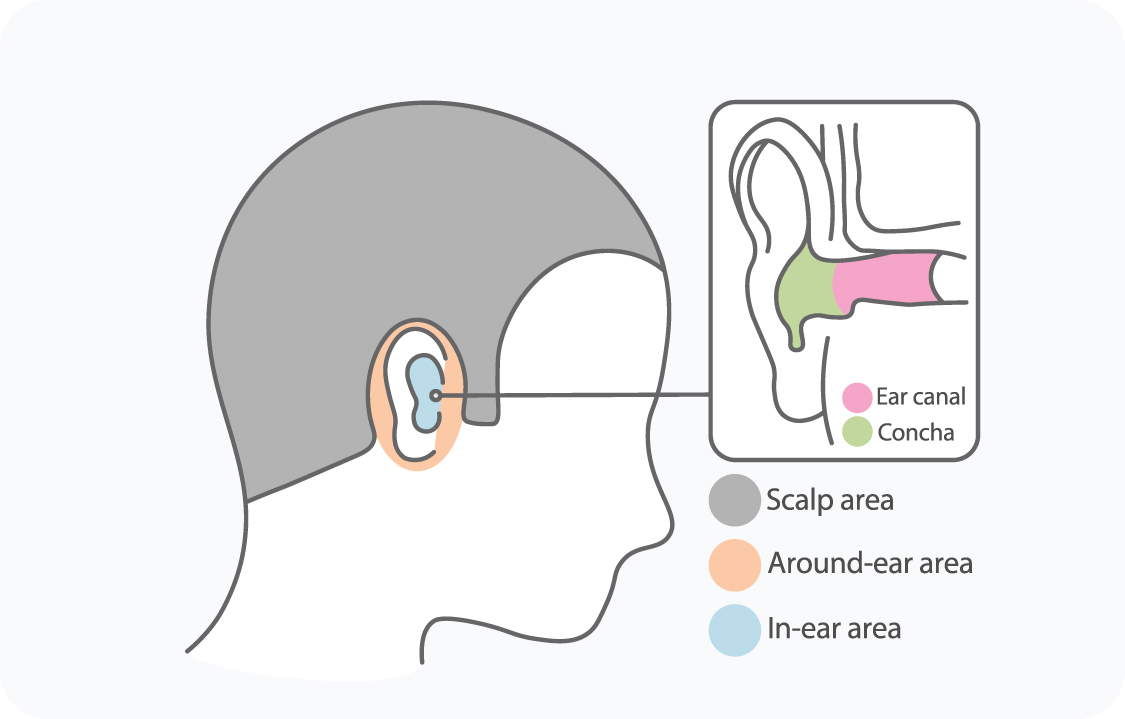 The future of wearable EEG: a review of ear-EEG technology and its ...