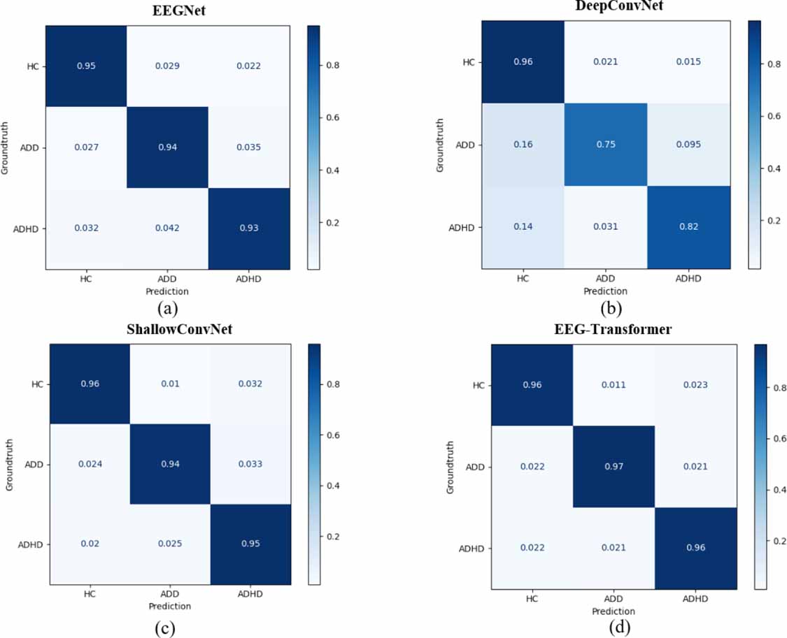 Classification of attention deficit/hyperactivity disorder based on EEG ...