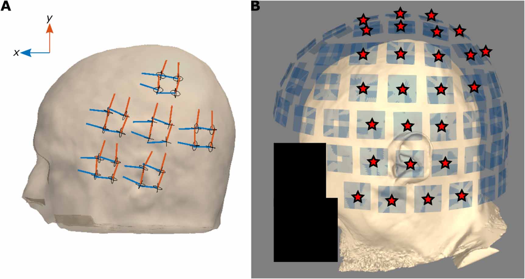 Single-trial classification of evoked responses to auditory tones using ...
