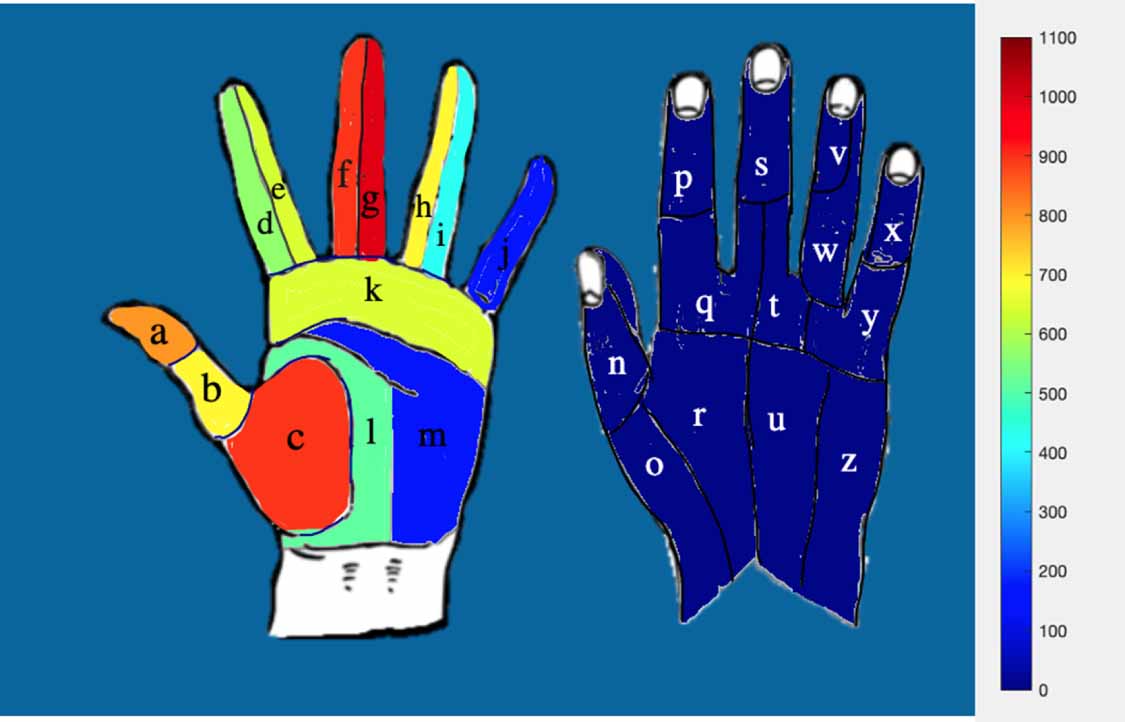 Exploration of sensations evoked during electrical stimulation of the ...