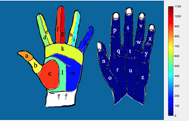 Exploration of sensations evoked during electrical stimulation of the ...