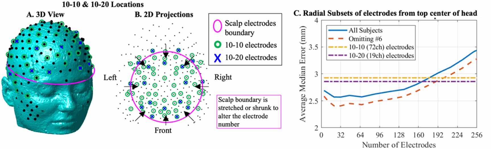 EEG electrode localization with 3D iPhone scanning using point-cloud ...