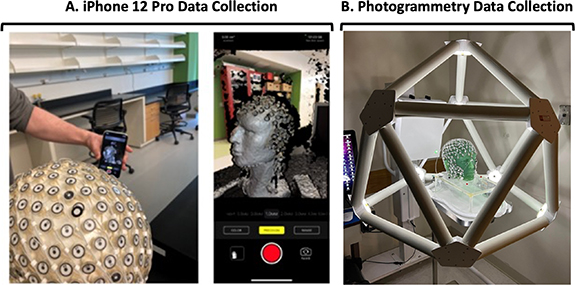 EEG electrode localization with 3D iPhone scanning using point-cloud ...