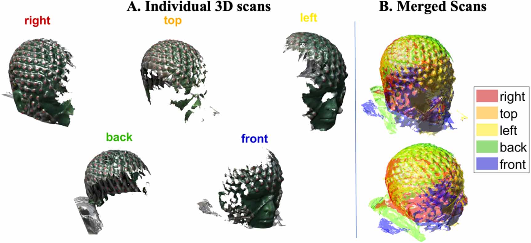 EEG electrode localization with 3D iPhone scanning using point-cloud ...