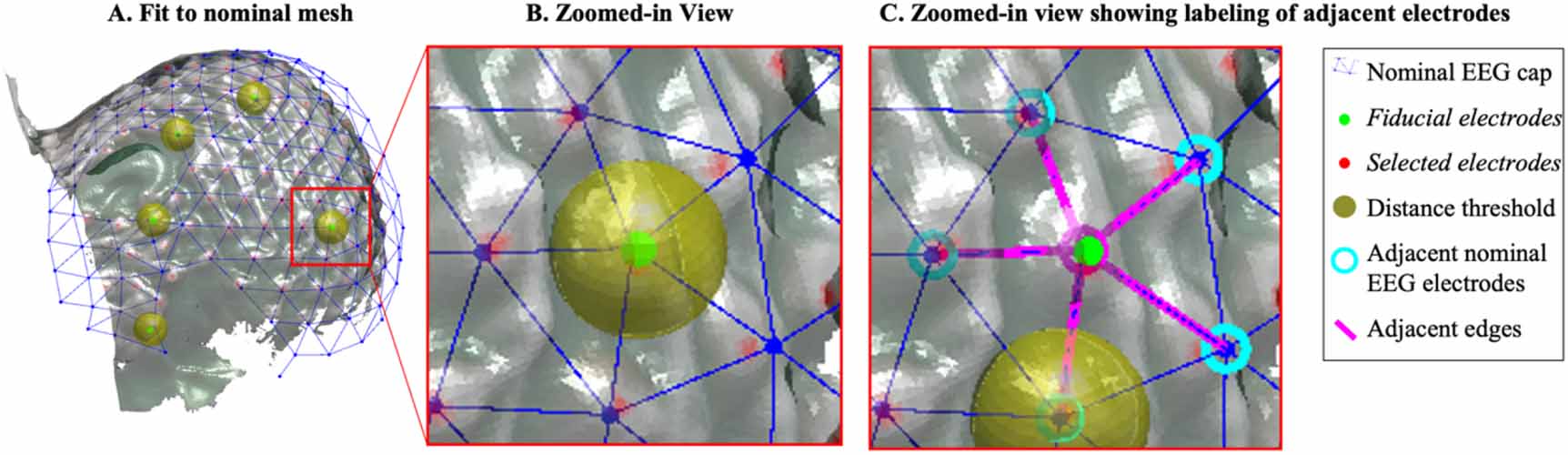 EEG electrode localization with 3D iPhone scanning using point-cloud ...