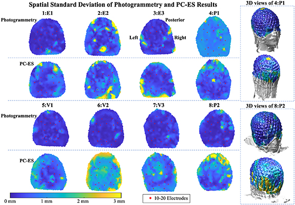 EEG electrode localization with 3D iPhone scanning using point-cloud ...