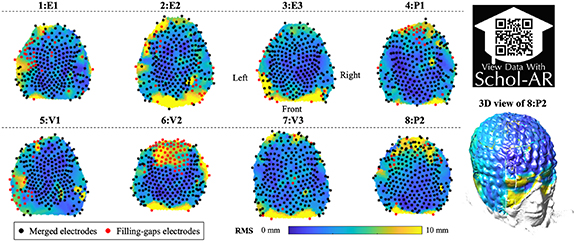 EEG electrode localization with 3D iPhone scanning using point-cloud ...