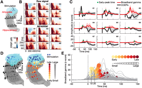Single-pulse electrical stimulation artifact removal using the novel ...