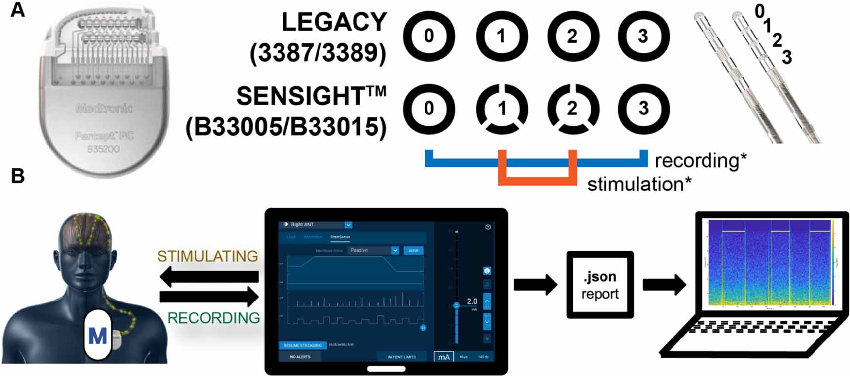 Neural signal data collection and analysis of Percept™ PC BrainSense ...