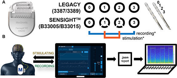 Neural signal data collection and analysis of Percept™ PC BrainSense ...