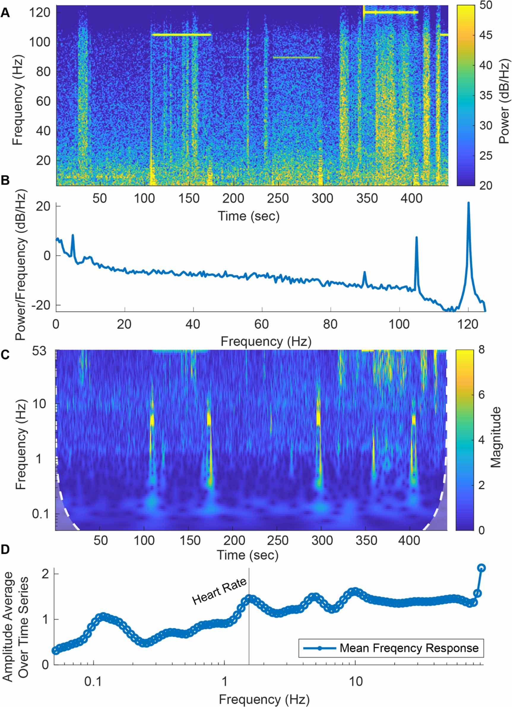 Neural signal data collection and analysis of Percept™ PC BrainSense ...