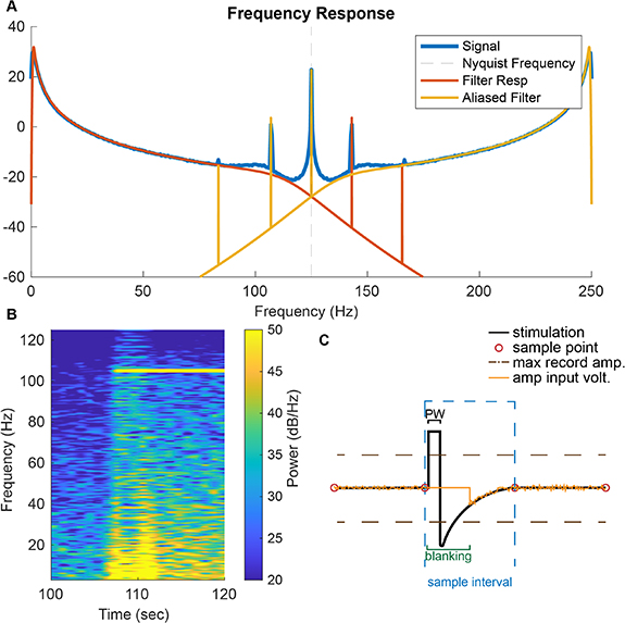 Neural signal data collection and analysis of Percept™ PC BrainSense ...