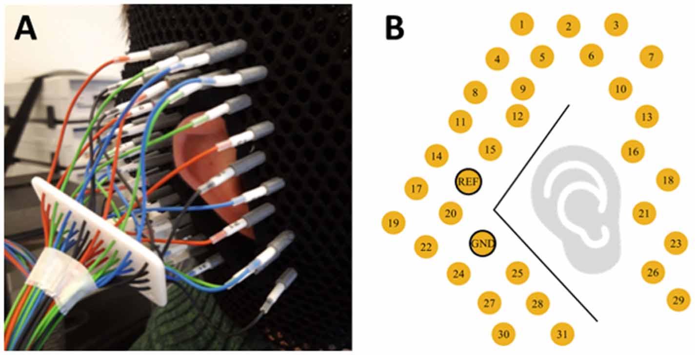 High-density ear-EEG for understanding ear-centered EEG - IOPscience