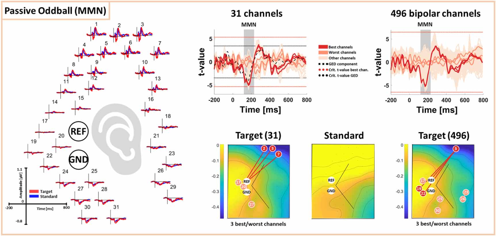 High-density ear-EEG for understanding ear-centered EEG - IOPscience
