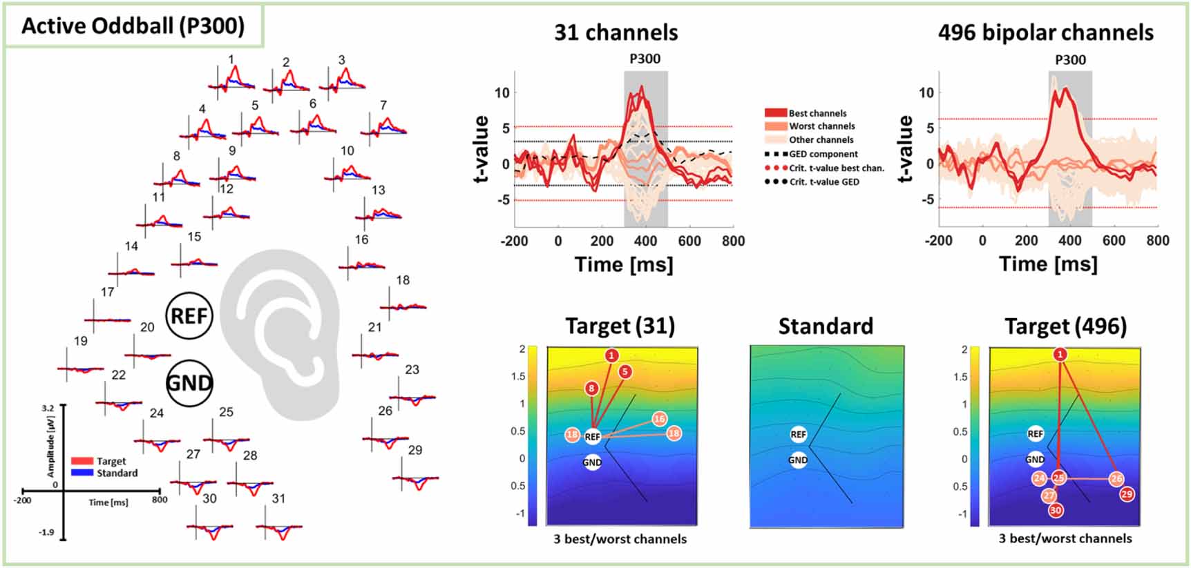 High-density ear-EEG for understanding ear-centered EEG - IOPscience