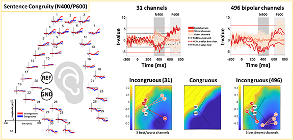 High-density ear-EEG for understanding ear-centered EEG - IOPscience
