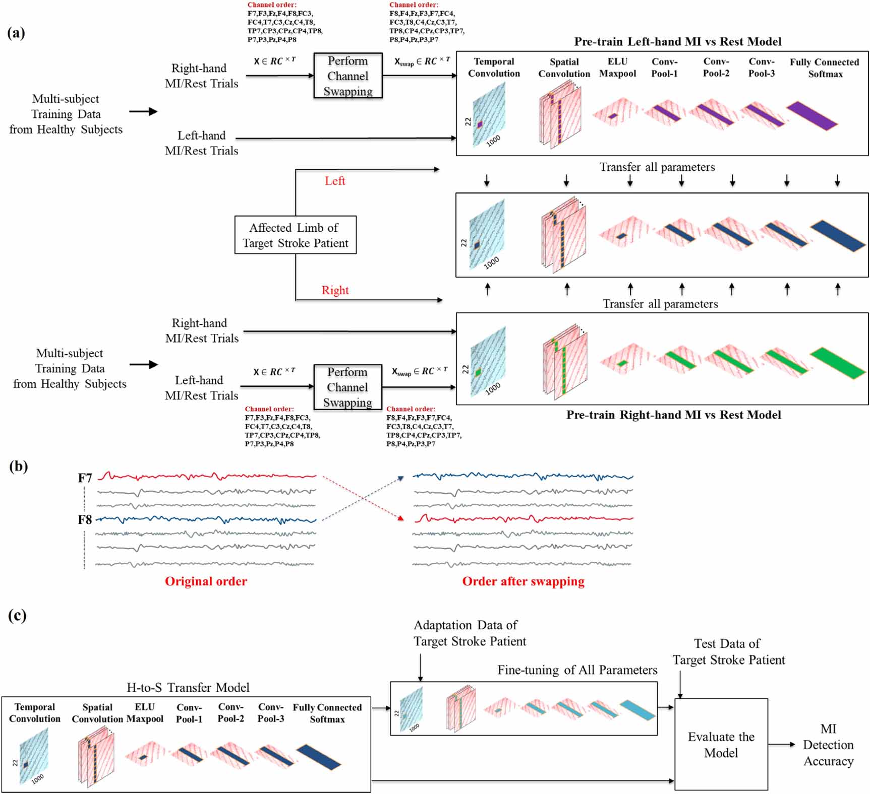 Transferring a deep learning model from healthy subjects to stroke ...