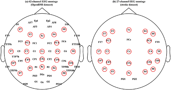 Transferring a deep learning model from healthy subjects to stroke ...