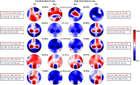 Transferring a deep learning model from healthy subjects to stroke ...