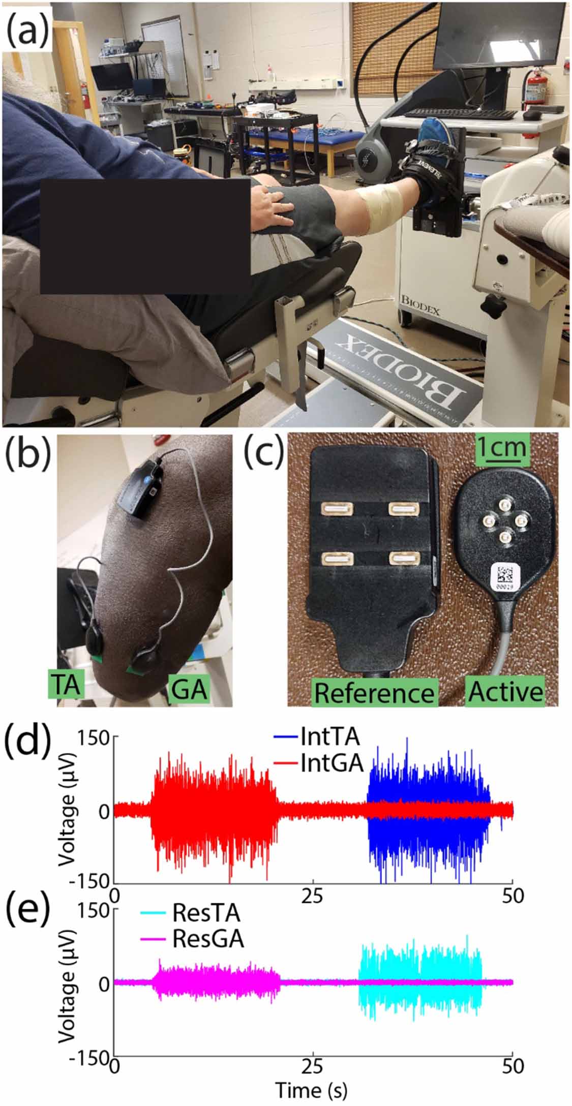Modified motor unit properties in residual muscle following transtibial ...
