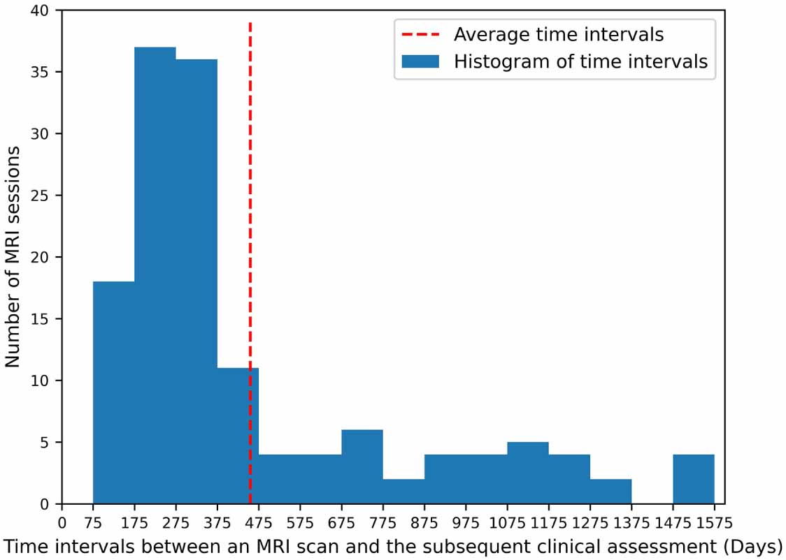 Early prediction of dementia using fMRI data with a graph convolutional ...