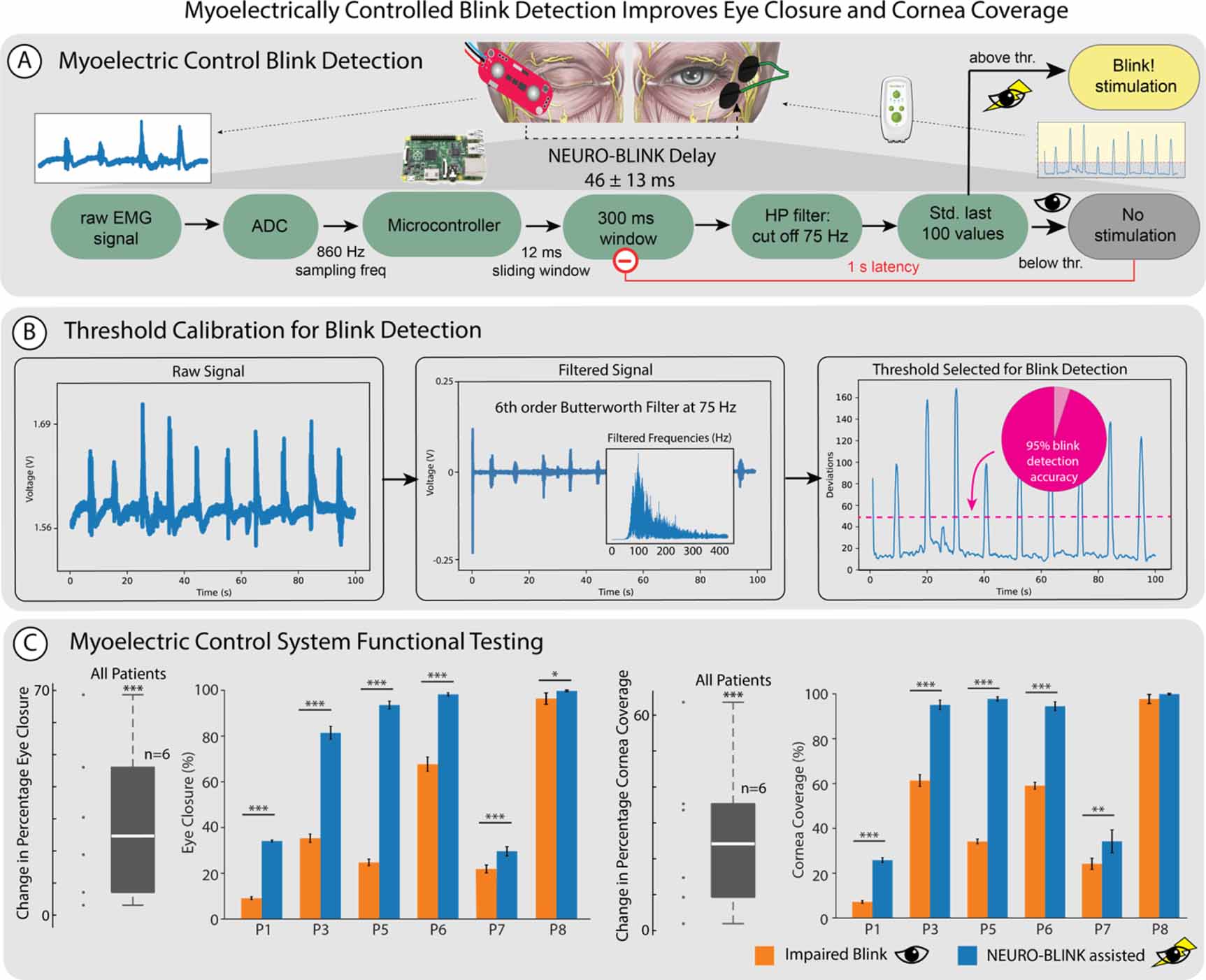 Bionic blink improves real-time eye closure in unilateral facial ...