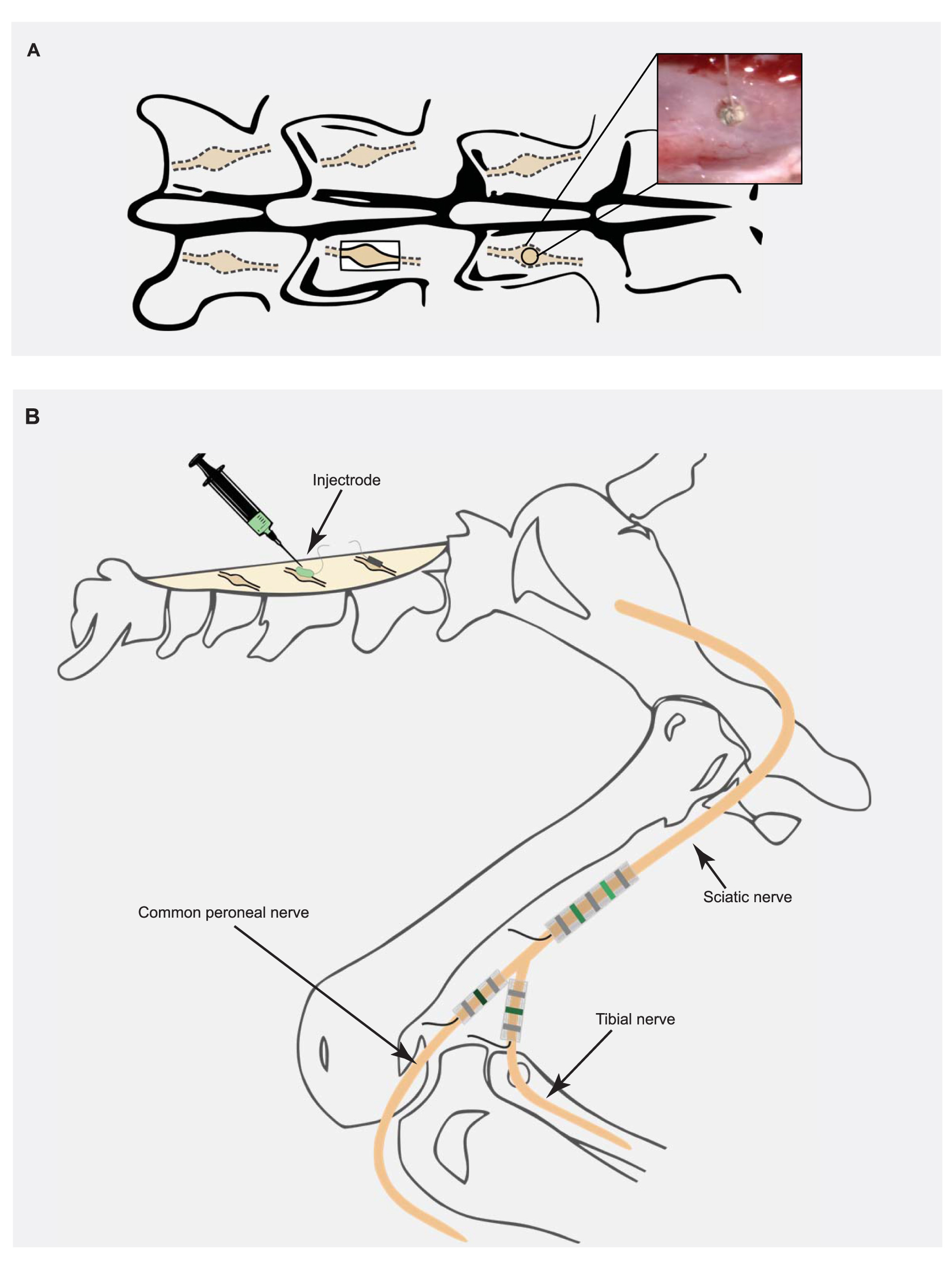 Computational modeling of dorsal root ganglion stimulation using an ...