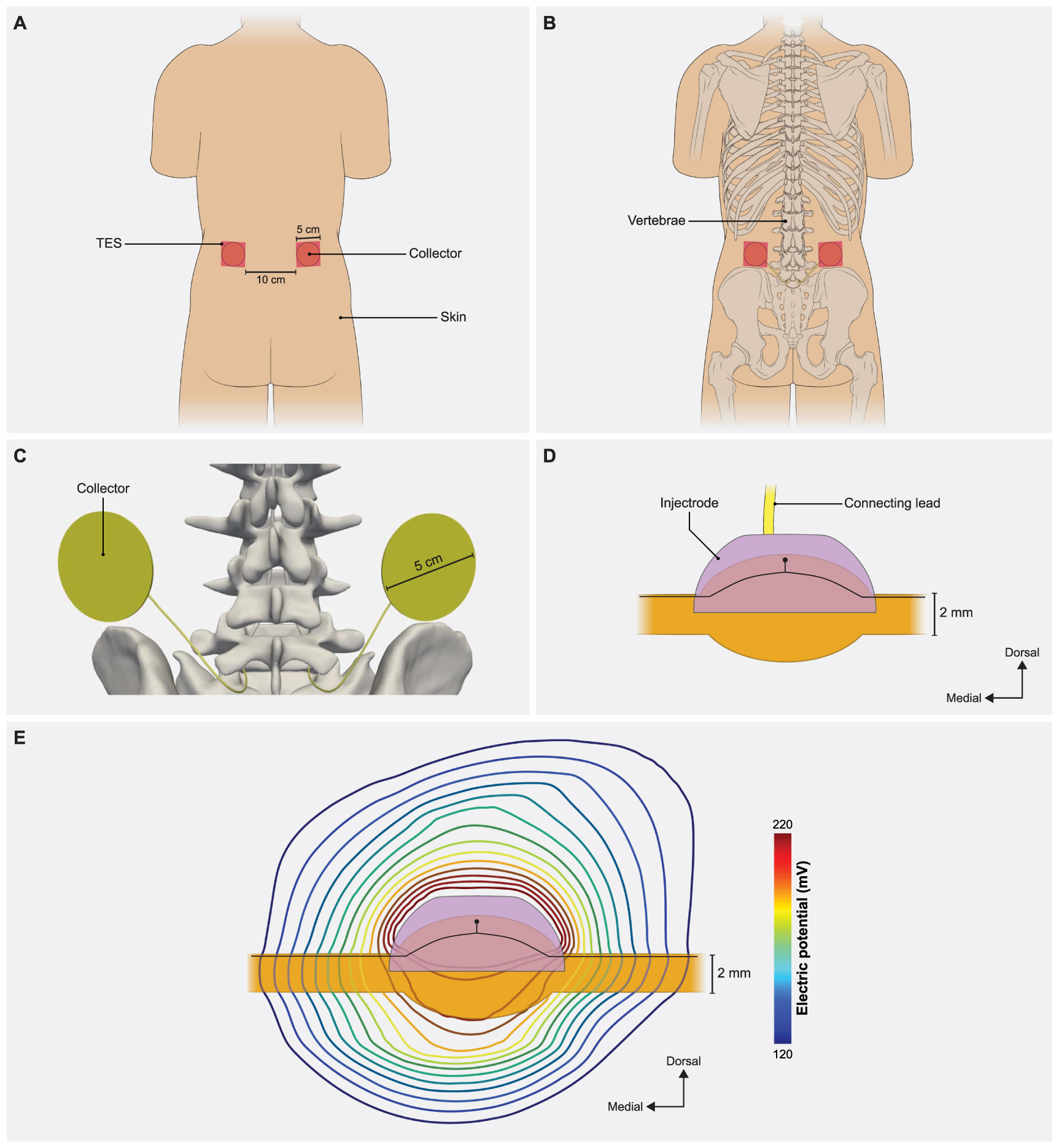 Computational modeling of dorsal root ganglion stimulation using an ...