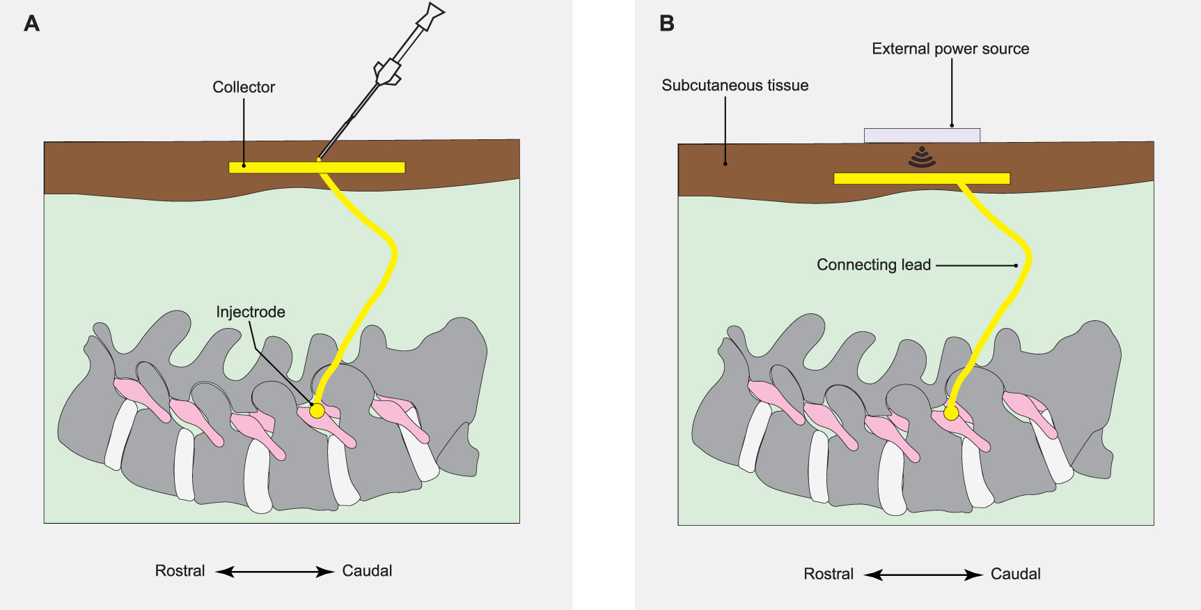 Computational modeling of dorsal root ganglion stimulation using an ...