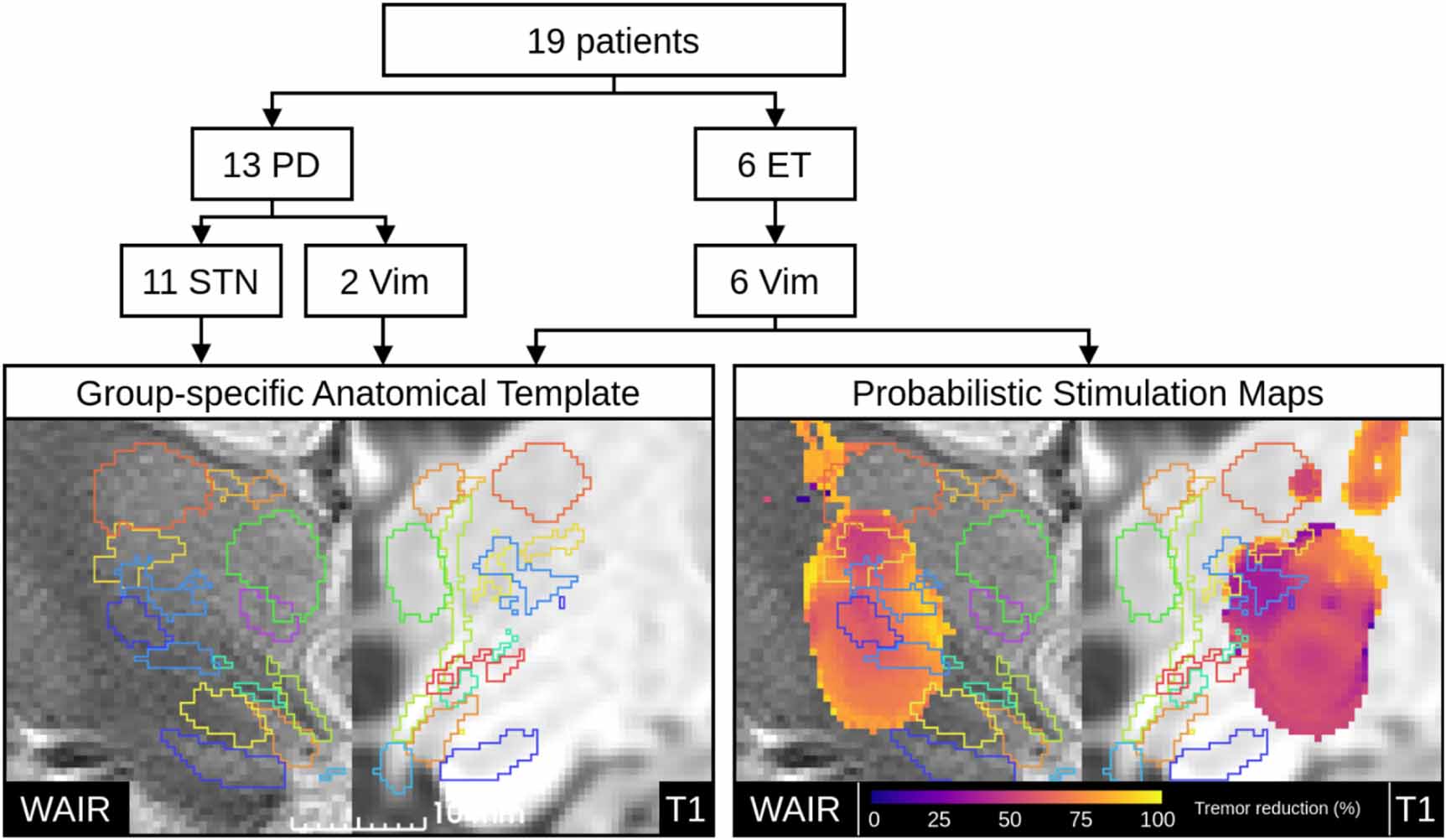 Probabilistic stimulation mapping from intra-operative thalamic deep ...