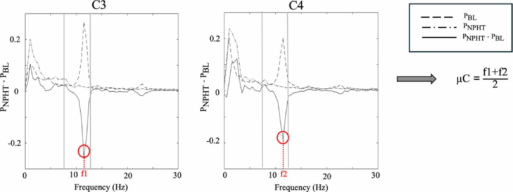 EEG connectivity in functional brain networks supporting visuomotor ...