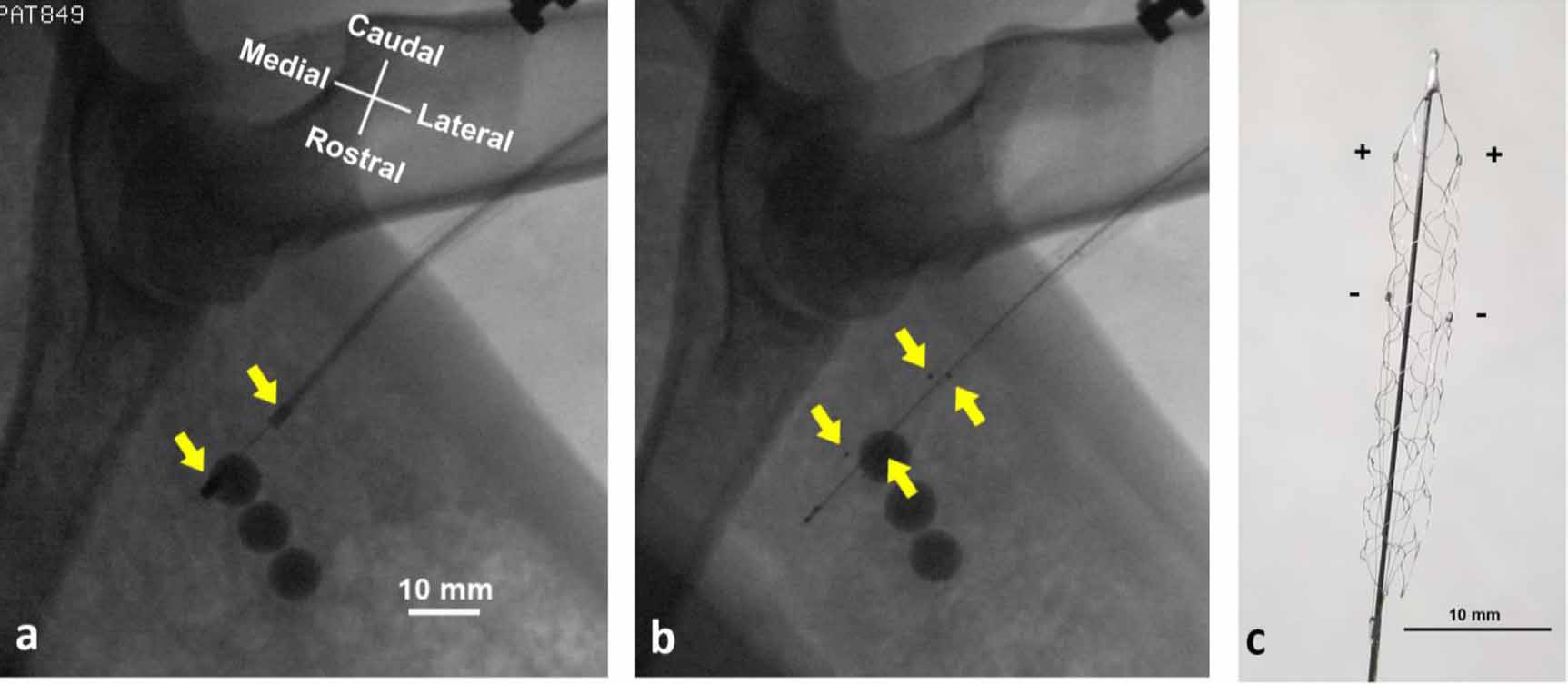 Feasibility of endovascular stimulation of the femoral nerve using a ...
